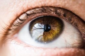Eye Muscle Imbalance: How To Treat A Crossed Or A Lazy Eye